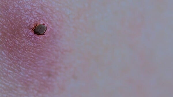 What Does a Tick Bite Look Like? (And How to Prevent Them)