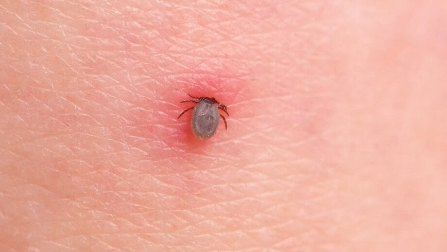 What Does a Tick Bite Look Like? (And How to Prevent Them)