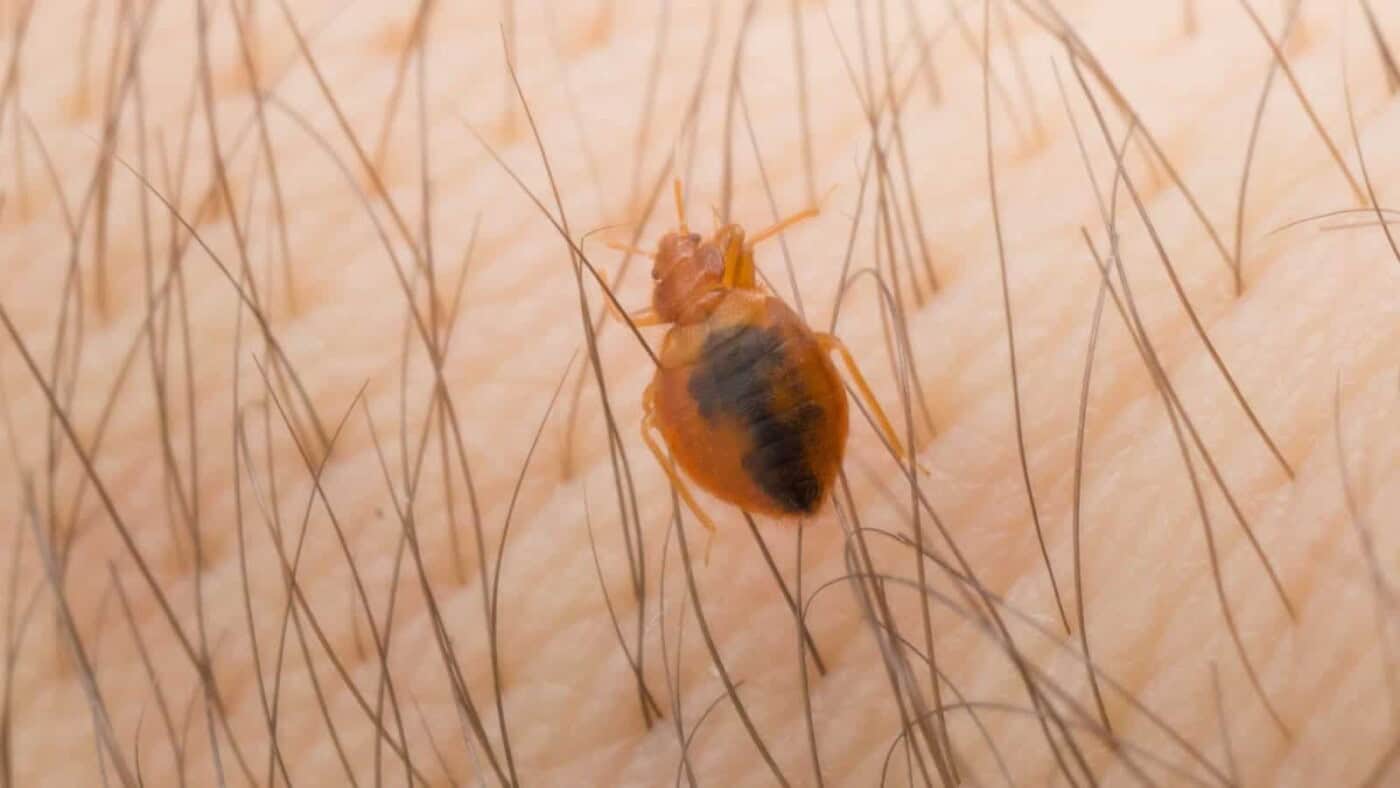 Bed Bug Bites: Pictures, Symptoms, Treatment, and Prevention