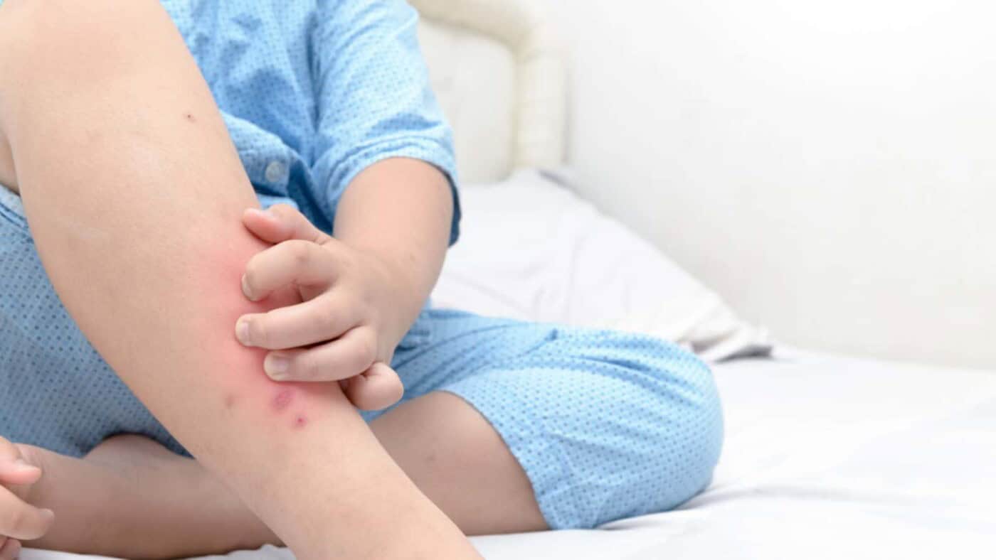 What Do Bed Bugs Look Like? (Complete Beginner's Guide)