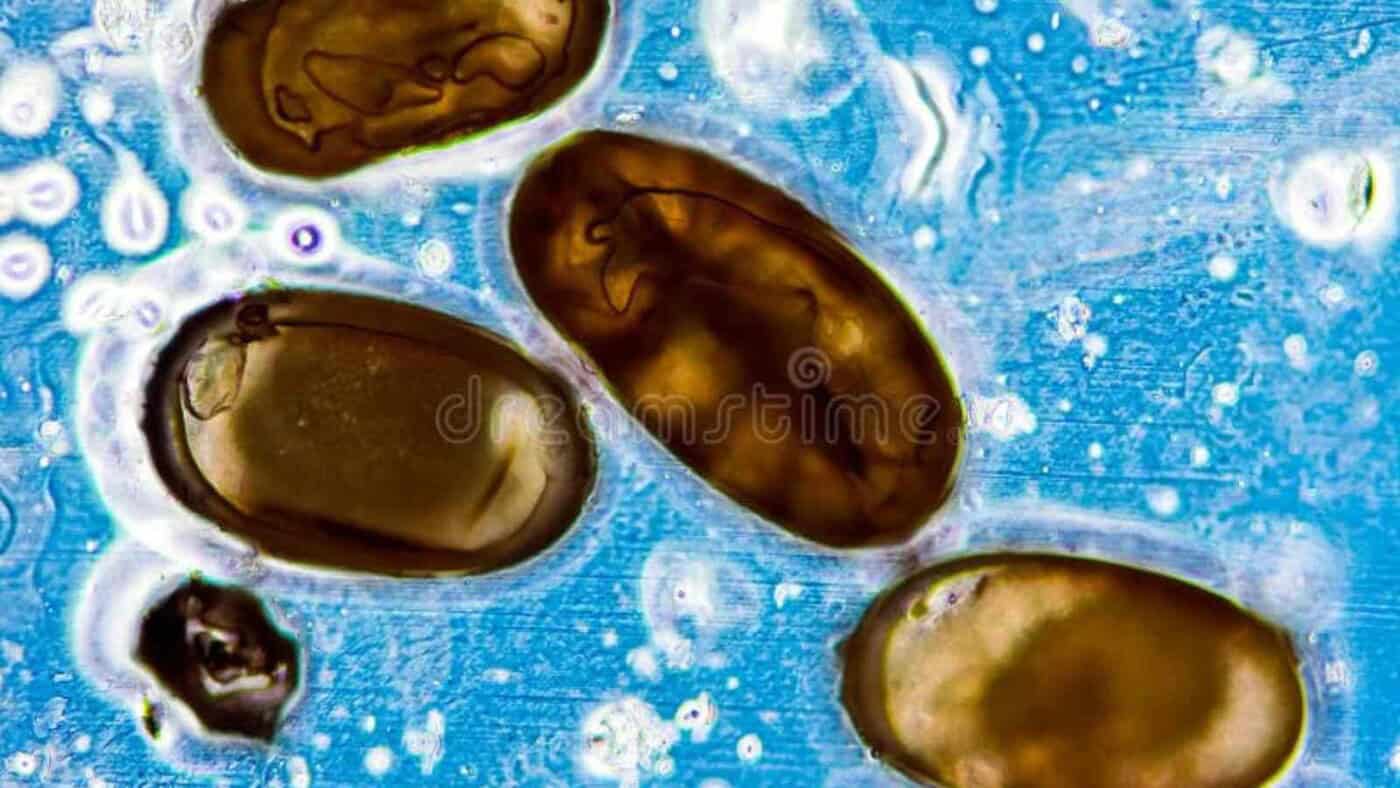 Flea Eggs: What Do They Look Like and How to Get Rid of Them