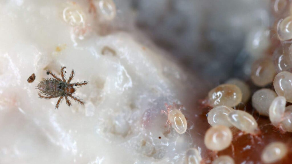 Mites: Different Types, Bites, and How to Get Rid of Them