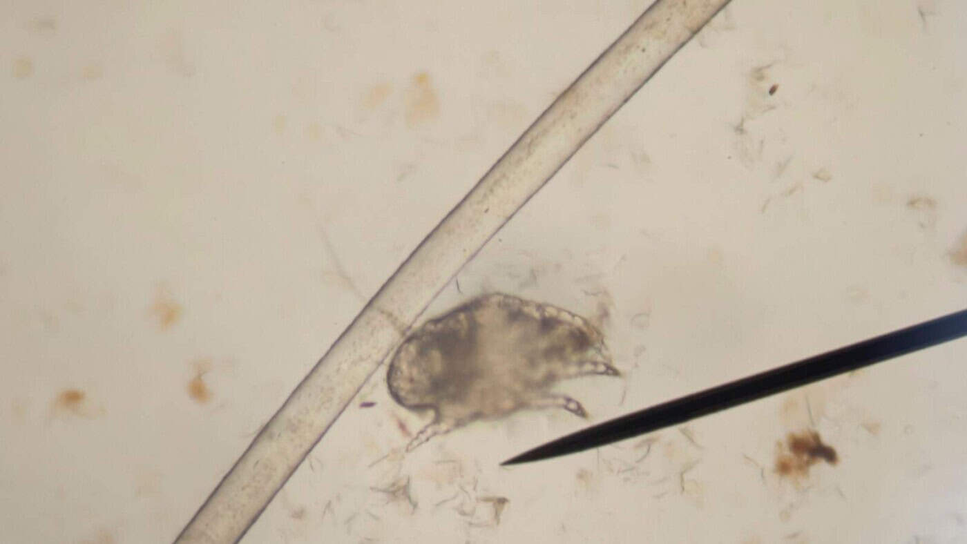 Mites: Different Types, Bites, and How to Get Rid of Them