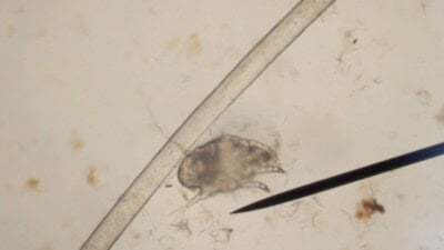 Mites: Different Types, Bites, and How to Get Rid of Them