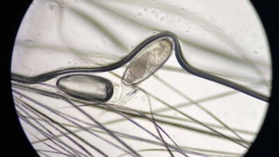 Mites: Different Types, Bites, and How to Get Rid of Them