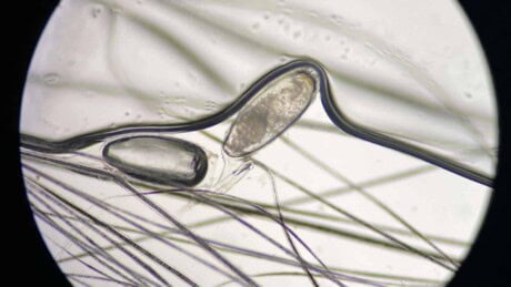 Mites: Different Types, Bites, and How to Get Rid of Them