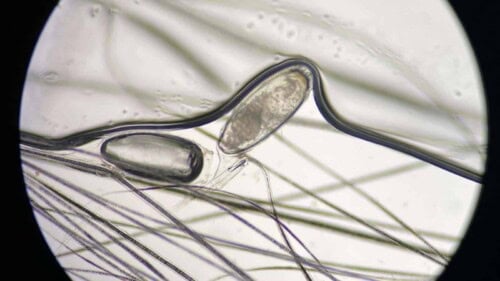 Mites: Different Types, Bites, and How to Get Rid of Them