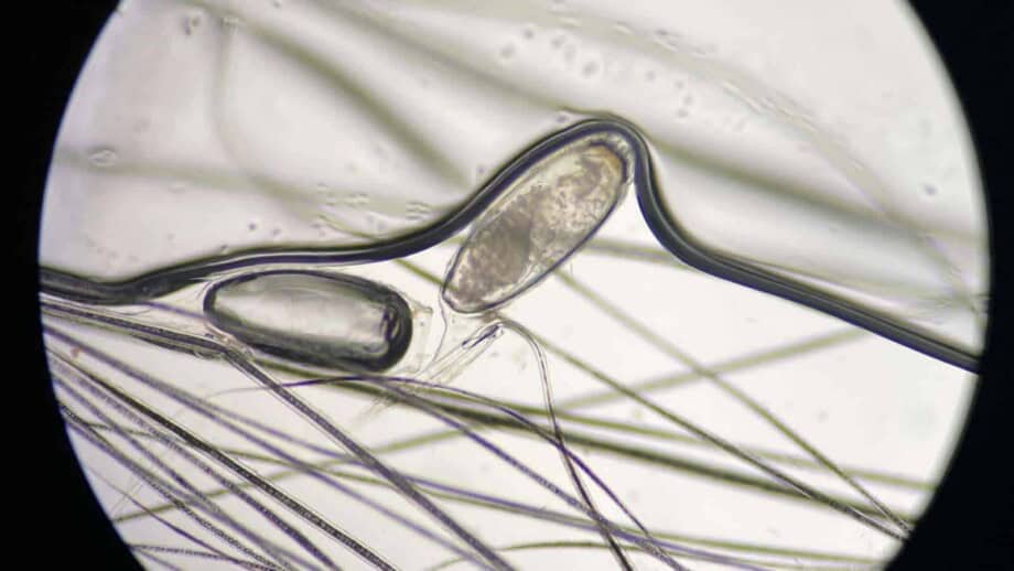 Mites: Different Types, Bites, and How to Get Rid of Them