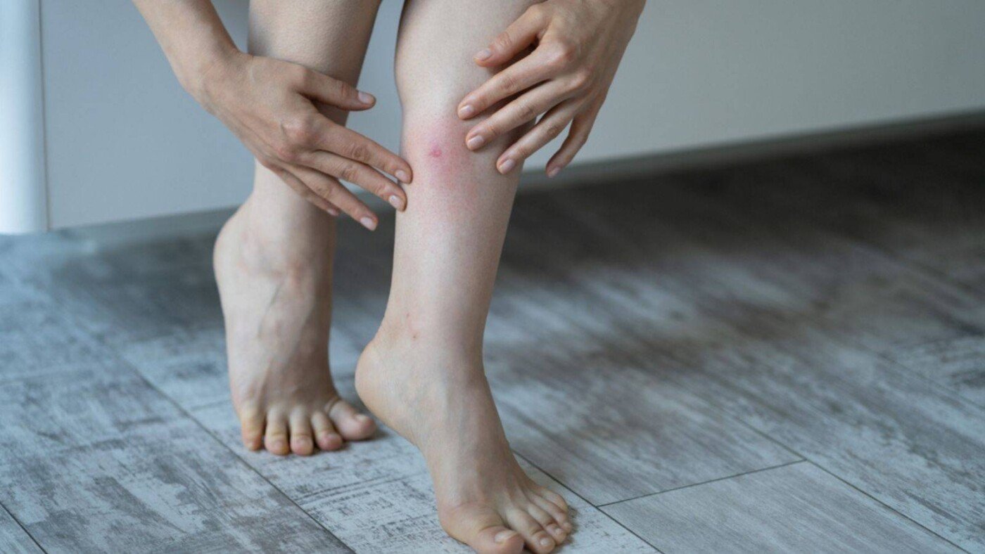 Can Fleas Fly? And How to Handle a Flea Infestation?